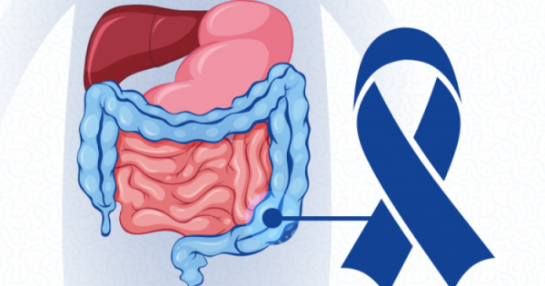 "Si te controlás, lo prevenís": la UNCUYO concientiza sobre el cáncer ...